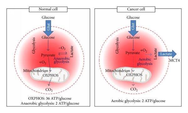 암세포의 대사는 어떻게 다른가? [아주아주 쉬운 암 대사치료] : 네이버 블로그