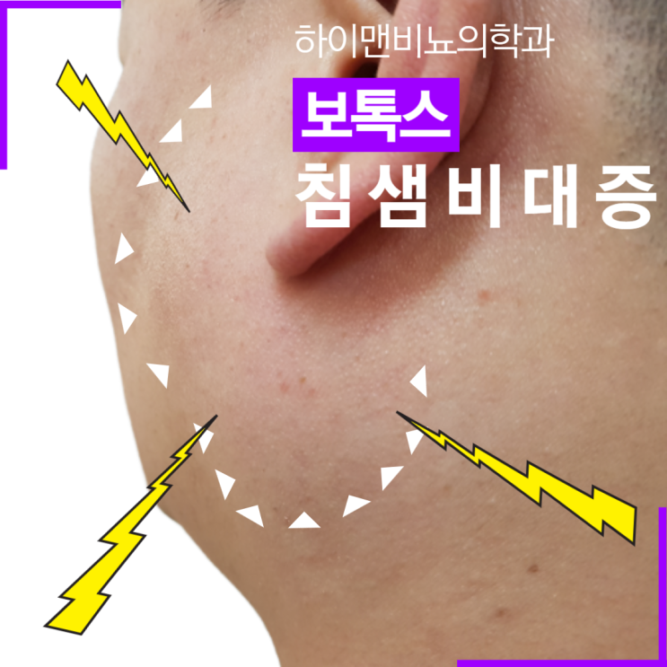 침샘비대증 침샘부음 보톡스 맞아야하나요 네이버 블로그