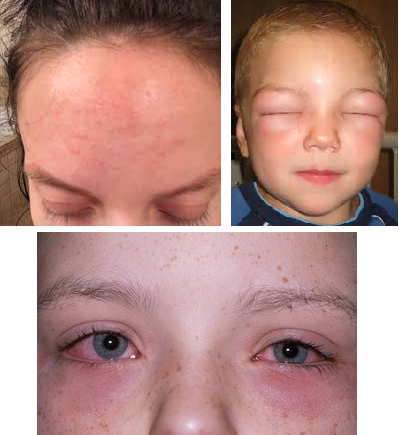 최초의 완전천연화장품 브랜드. 코즈볼(COSBALL). 아토피나 피부질환에 안심하고 쓰자. : 네이버 블로그