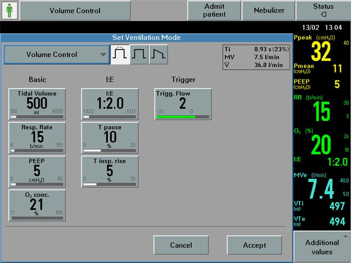 SERVO-i trigger sensitivity 설정방법 : 네이버 블로그