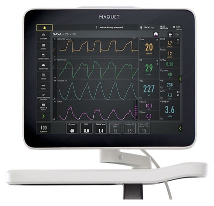 NAVA (Neurally Adjusted Ventilatory Assist) : 네이버 블로그