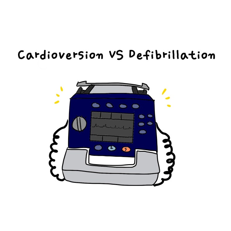 [뽀너스×채린] 임상엿보기 - 32. "cardioversion VS Defibrillation" : 네이버 블로그