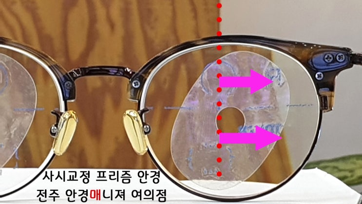 소아 사시로 초등학생 때 수술을 했지만 치료되지 않아 성인 사시로 불편한 50대 남성 외사시좌안 상사시교정 프리즘 안경
