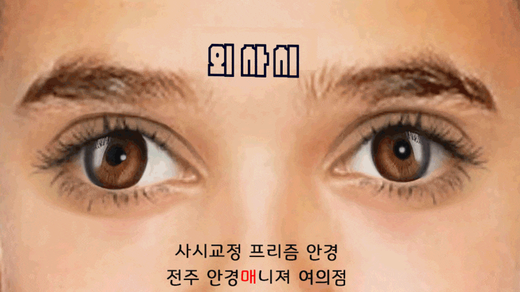 성인 사시 교정 프리즘 안경을 맞추는 가장 큰 이유 중 하나 정확한 시선 처리와 대인 관계의 자신감입니다 네이버 블로그