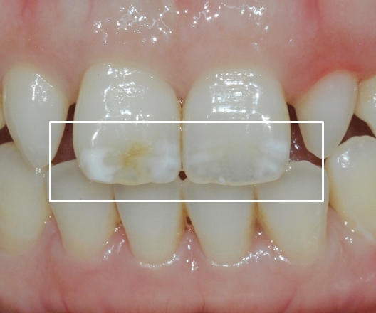 4. 기초 치과(390p ~ 393p) : 네이버 블로그