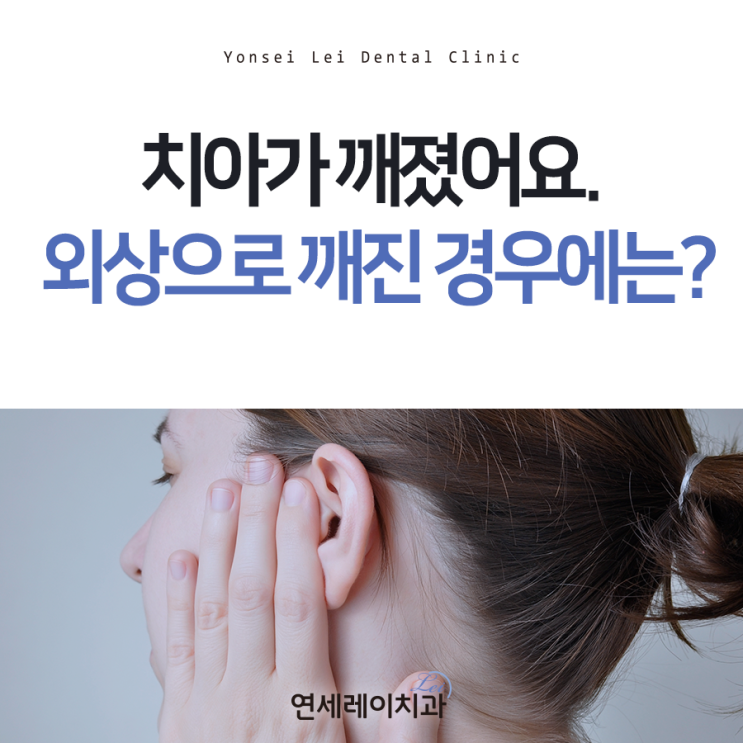 치아가 깨졌어요 외상으로 깨진 경우에는 네이버 블로그