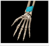 해부학 근육학 아래팔근육forearm Muscle 앞칸 네모엎침근방형회내근ㆍpronator Quadratus