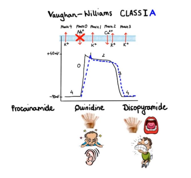 [항부정맥제] ClassⅠA(Na+ channel blocker) : 네이버 블로그