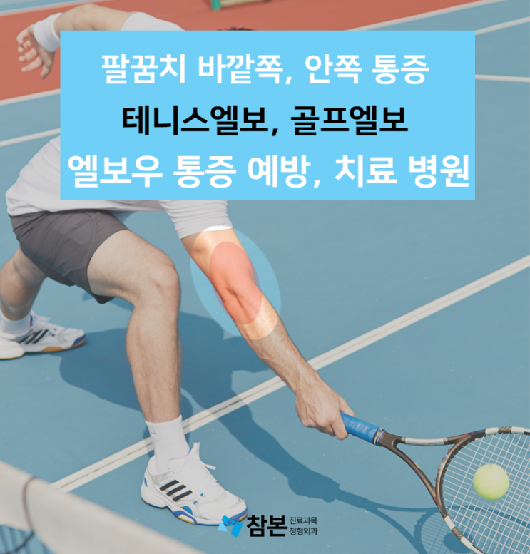 팔꿈치 바깥쪽 안쪽 통증 테니스엘보 골프엘보 엘보우 통증 예방 치료 병원 네이버 블로그