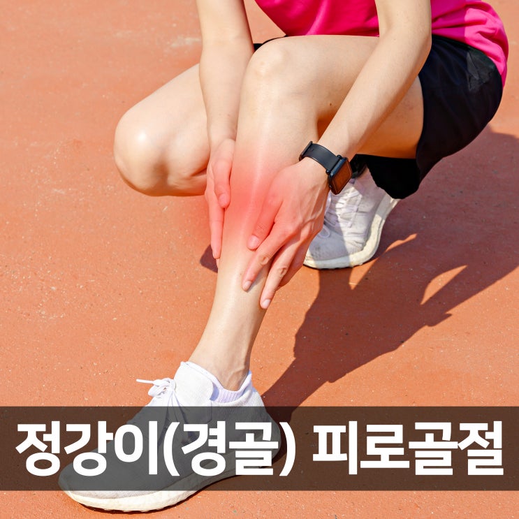 정강이 통증 경골 피로골절 증상의 원인은 빠른 치료가 중요 네이버 블로그