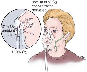 007. 신규 간호사를 위한 산소요법 (FiO2 계산, flow의 이해) : 네이버 블로그