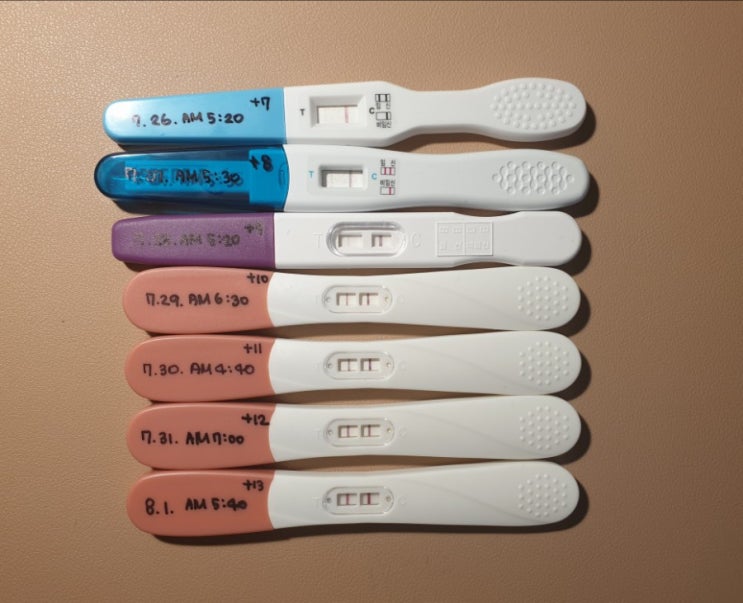 난임 일기17 배란 11일째 임테기 12일째 임테기 시험관 피검사 수치 궁미경 교수님 네이버 블로그
