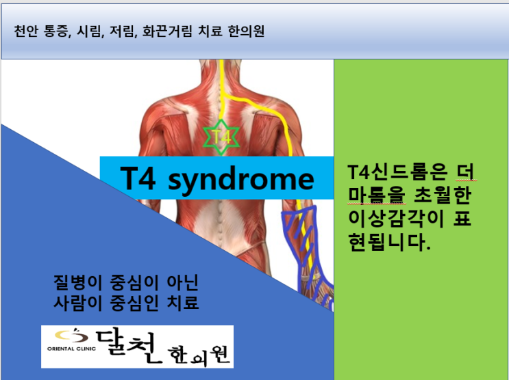 T4 syndrome(신드롬)[천안.아산. 한의원] : 네이버 블로그