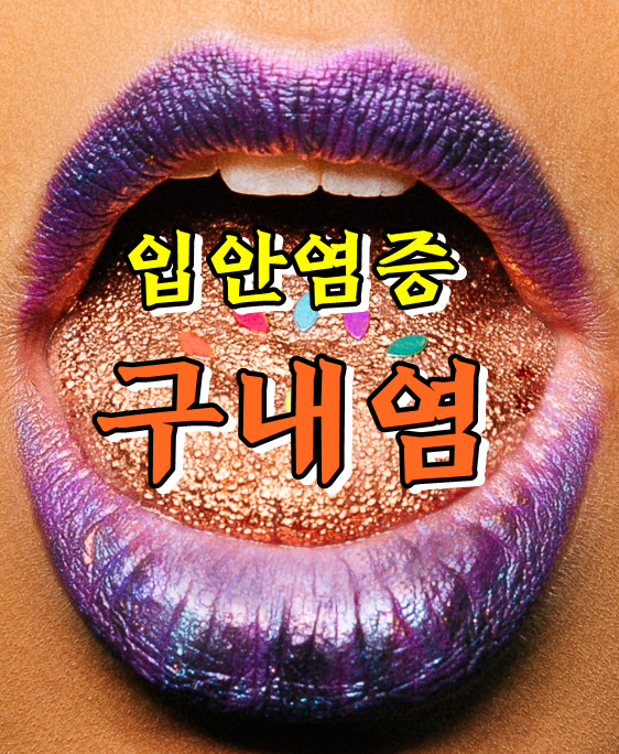 궤양성, 수포성, 미란성 구내염! 주의하세요. : 네이버 블로그