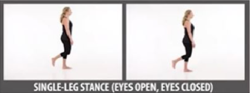 [SFMA] SFMA Top Tier - 6.한발 서기 검사 (Single leg stance) : 네이버 블로그