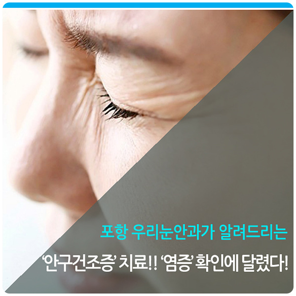포항안과 우리눈안과 ‘안구건조증 치료성공 ‘염증 확인에 달렸다 네이버 블로그