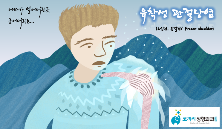 김해오십견치료 결코 쉽게 봐서는 안되는 유착성 관절낭염에 대한 핵심 정리 네이버 블로그