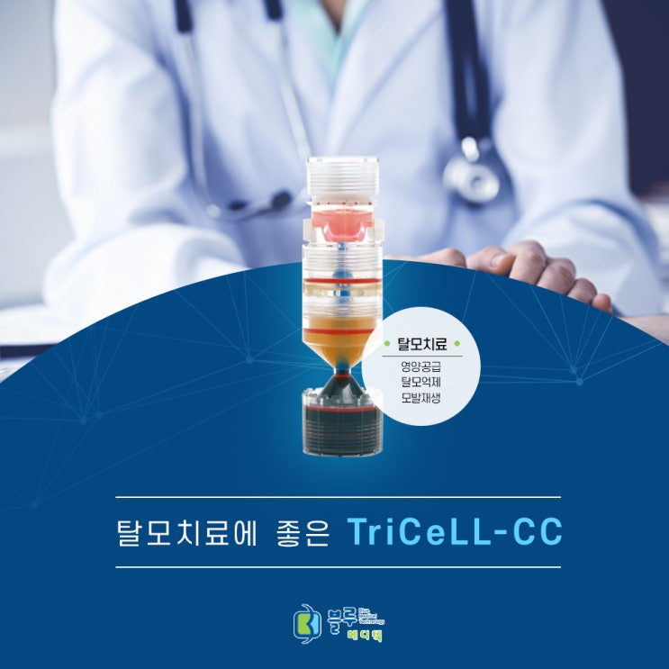 [성형외과,PRP의료기기] 탈모치료에 효과적인 TriCell-CC 제품 소개 : 네이버 블로그