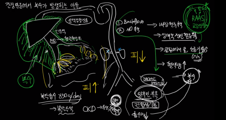 Youtube기역님 간 And 식도정맥류 출혈 And 복수 네이버 블로그