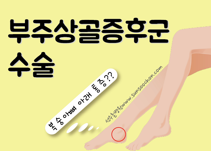 부주상골증후군 수술 決定 결정은 어떻게 네이버 블로그