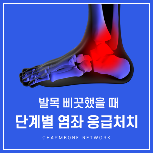 발목 삐끗했을 때 단계별 염좌 응급처치 네이버 블로그