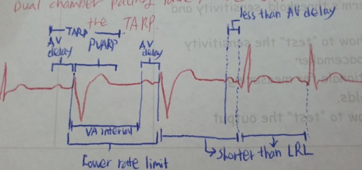 pacemaker 이해하기 (내 수준으로 이해하기) : 네이버 블로그