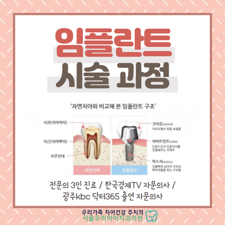 광주야간진료치과 임플란트치과추천 서울우리아이치과 임플란트 시술과정 주의사항 네이버 블로그