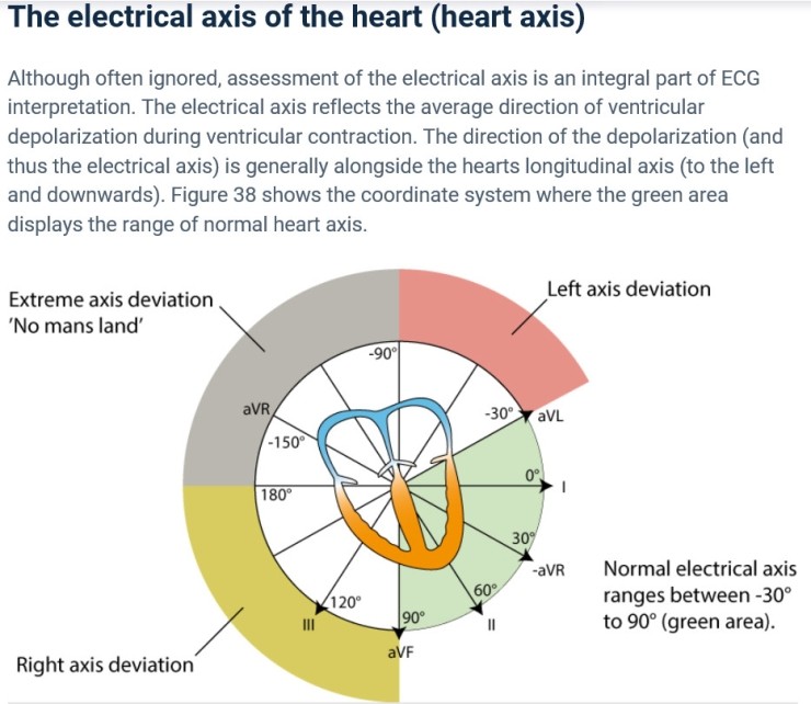 [ECG 기초] electrical Axis of the heart : 네이버 블로그