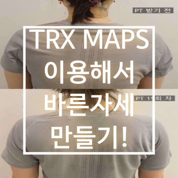 노원역PT 체형분석장비 TRX maps 를 이용해서 바른자세만들기! : 네이버 블로그