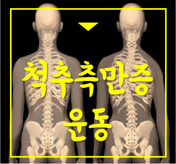 척추측만증척추측만증운동미아동헬스장미아역헬스장삼양동헬스장솔샘역헬스장솔샘역줌바솔샘역스피닝솔샘역요가솔샘역pt미아