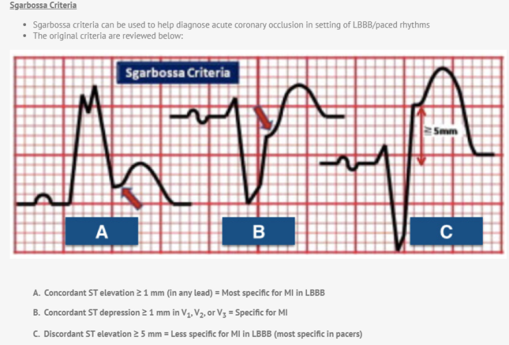 Sgarbossa criteria, AMI in LBBB and ventricular pacing : 네이버 블로그