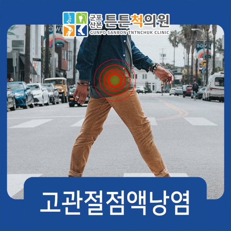 산본 정형외과 산본야간진료 걸을 때마다 골반이 쑤신다면 고관절점액낭염 네이버 블로그