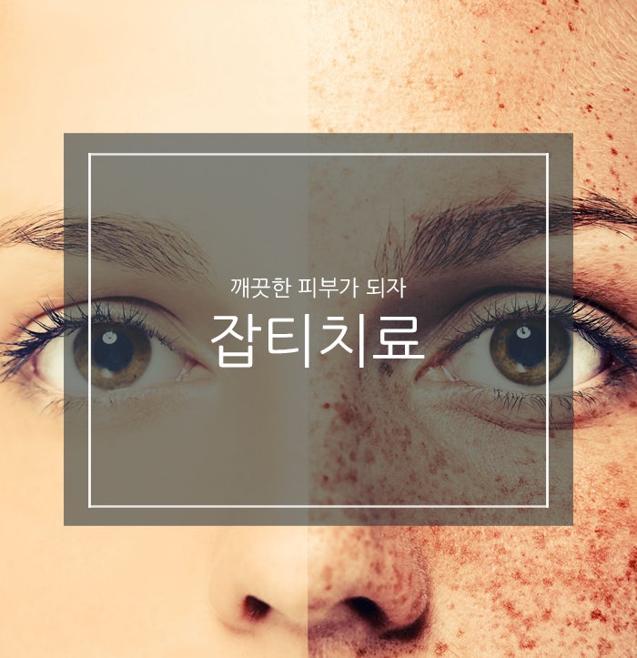 얼굴잡티제거 춘천 클라리티레이저 파스텔토닝으로 치료하세요 네이버 블로그