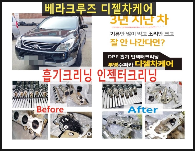 베라크루즈 디젤차케어 인젝터크리닝 흡기크리닝시공 흡기매니폴드흡기포트인젝터egr쿨러 부천 디젤차케어 Dpf흡기인젝터크리닝
