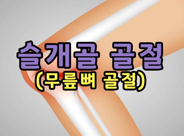 교통사고로 인한 슬개골 골절무릎뼈 골절은 맥브라이드 장해평가방법으로 보상합니다 네이버 블로그