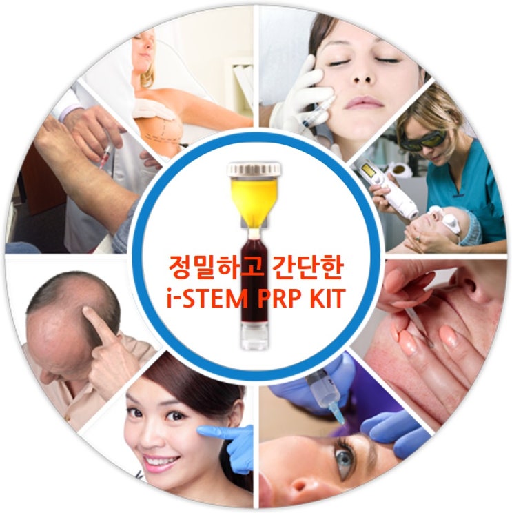 정품 i-STEM PRP 키트의 장점! : 네이버 블로그