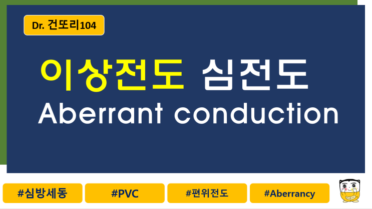 이상/편위전도(Aberrant conduction, aberrancy) 심전도 이해 : 네이버 블로그