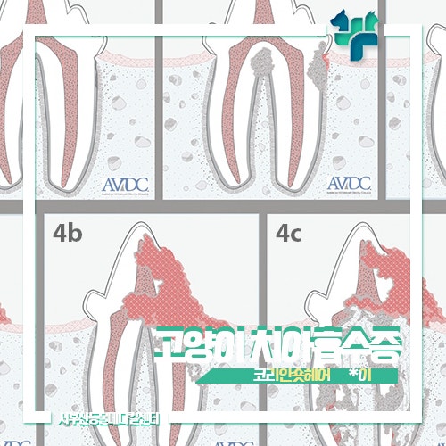 고양이치아흡수성병변(FORL:Feline Odentoclastic Resorptive Lesion) , 길냥이 침흘림, 고양이 ...