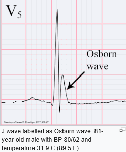 J wave : 네이버 블로그