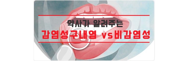 구내염 재발성 아프타성 궤양이랑 헤르페스 구내염이랑 어떻게 다른가치과의사가 꼭 알아야할 구내염 네이버 블로그