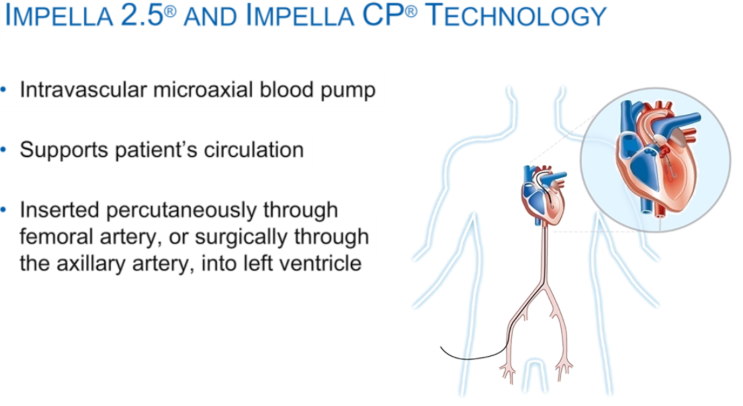 Impella : 네이버 블로그