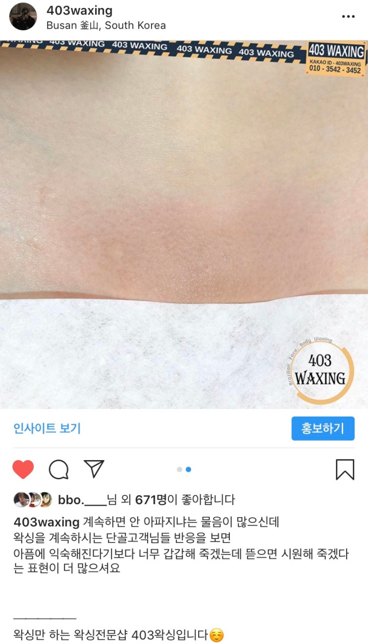부산 수영왁싱 인그로운헤어 제거까지 완벽 후기가 가득한 403왁싱 네이버 블로그