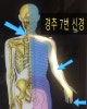 좌측 검지 저림 팔꿈치 통증 목통증 어깨통증 2020 3 2 목디스크 2주 입원치료 후 내원 교통사고 치료 네이버 블로그