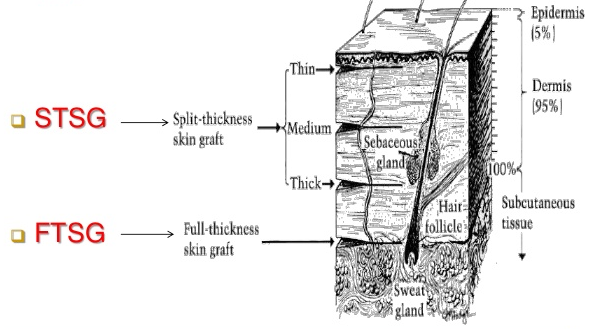 FTSG (Full Thickness Skin Graft) 전층 피부 이식술 : 네이버 블로그