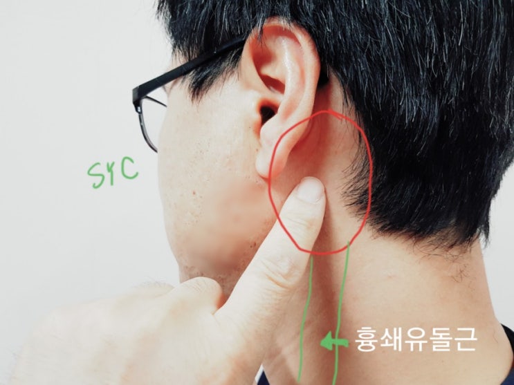 귀 뒤 후두부 목부위 만져지는 것이 있어요 귀 뒤 멍울 임파선염 네이버 블로그