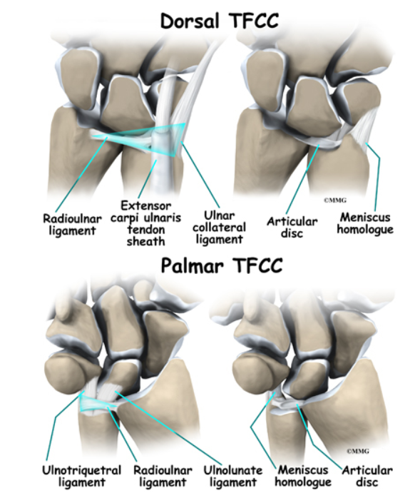 삼각섬유연골 복합체(TFCC) 손상 - 새끼손가락 손목통증 : 네이버 블로그