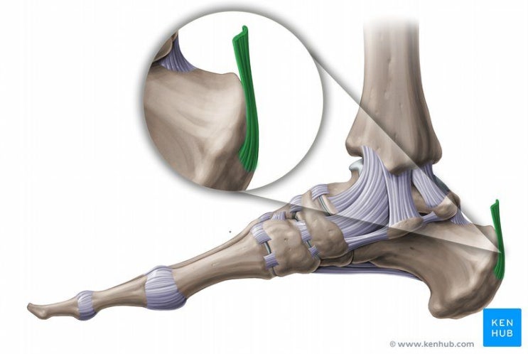 [성신여대한의원]아킬레스건 파열(Achilles tendon rupture) 및 톰슨 테스트(Thompson squeeze ...