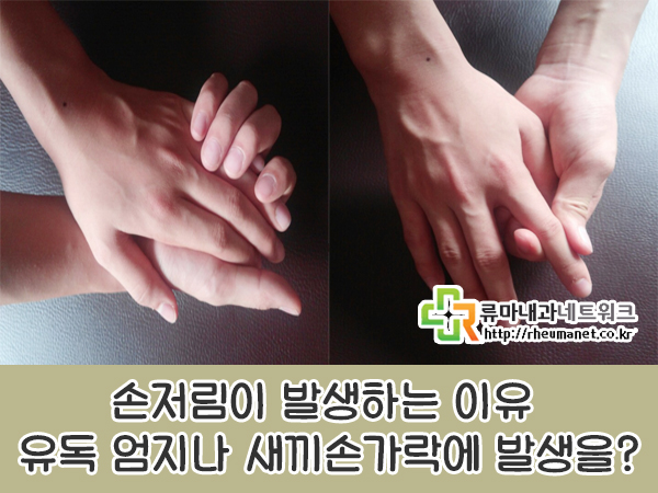 손저림원인을 생각해보고 엄지나 새끼 손가락저림 왜 생길까 네이버 블로그
