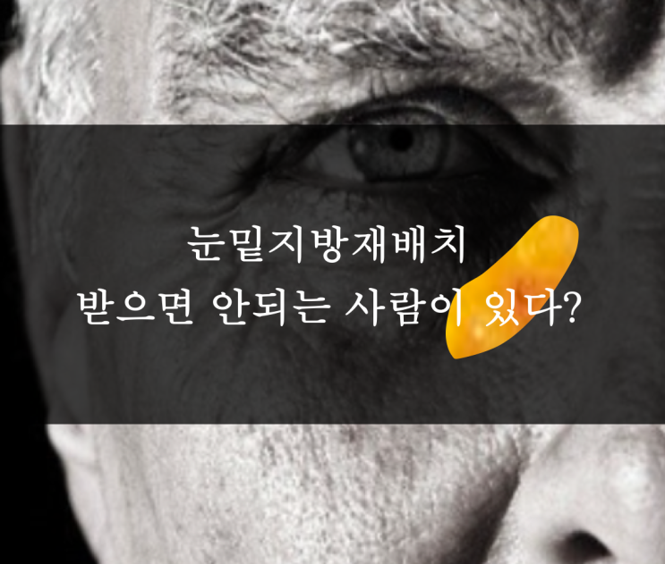 눈밑지방재배치 하면 안되는 사람이 있다? positive vector or negative vector, malar ...