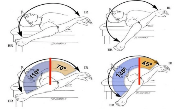 GIRD(Glenohumeral Internal Rotation Deficit) - 관절와 상완관절 내회전 결핍) : 네이버 블로그